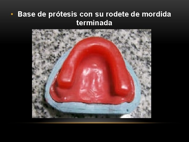 RODETES Andrea Ramrez Paola Snchez DIMENSION VERTICAL Relacin