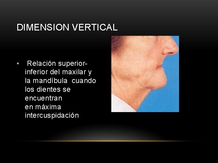 RODETES Andrea Ramrez Paola Snchez DIMENSION VERTICAL Relacin