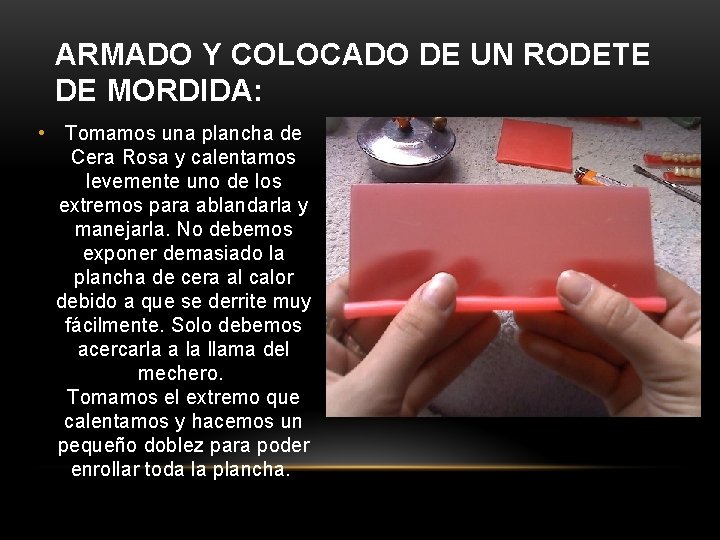 RODETES Andrea Ramrez Paola Snchez DIMENSION VERTICAL Relacin