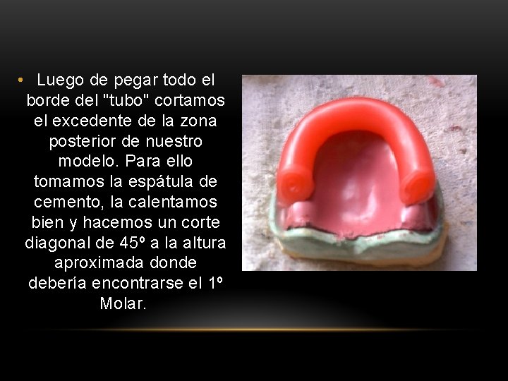 RODETES Andrea Ramrez Paola Snchez DIMENSION VERTICAL Relacin