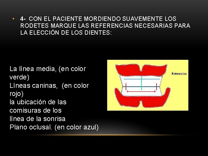 RODETES Andrea Ramrez Paola Snchez DIMENSION VERTICAL Relacin