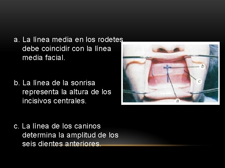 RODETES Andrea Ramrez Paola Snchez DIMENSION VERTICAL Relacin