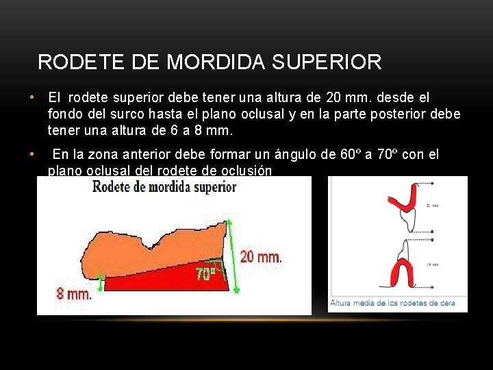 RODETES Andrea Ramrez Paola Snchez DIMENSION VERTICAL Relacin