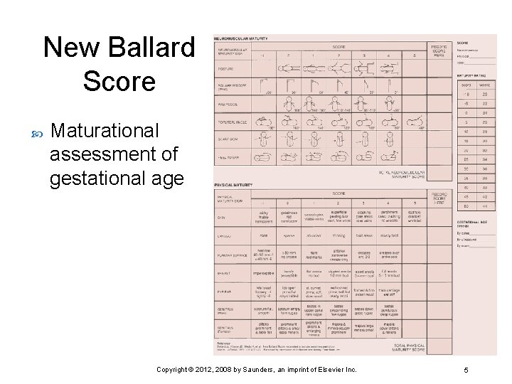 Chapter 15 The Newborn at Risk Conditions Associated
