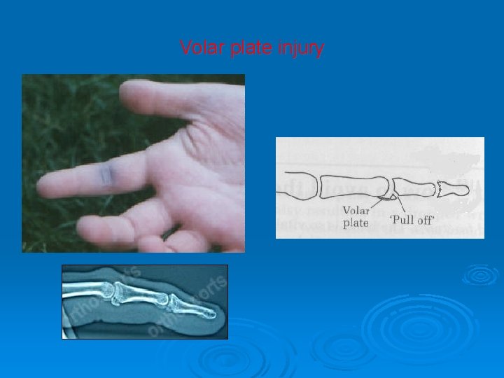 Hand Assessment and Common Injuries Objectives Understand how