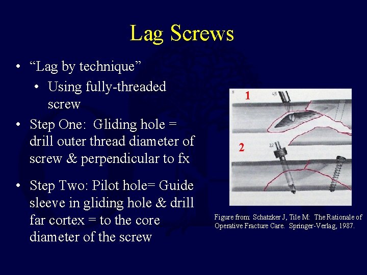 Basic Principles and Techniques of Internal Fixation of