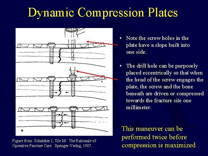 Basic Principles and Techniques of Internal Fixation of