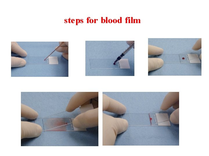 Smear Preparation Amar saeed Smear preparation For examination
