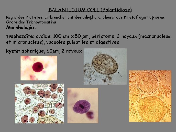 COURS DE PARASITOLOGIE DUT ABB 6 Les Filaires