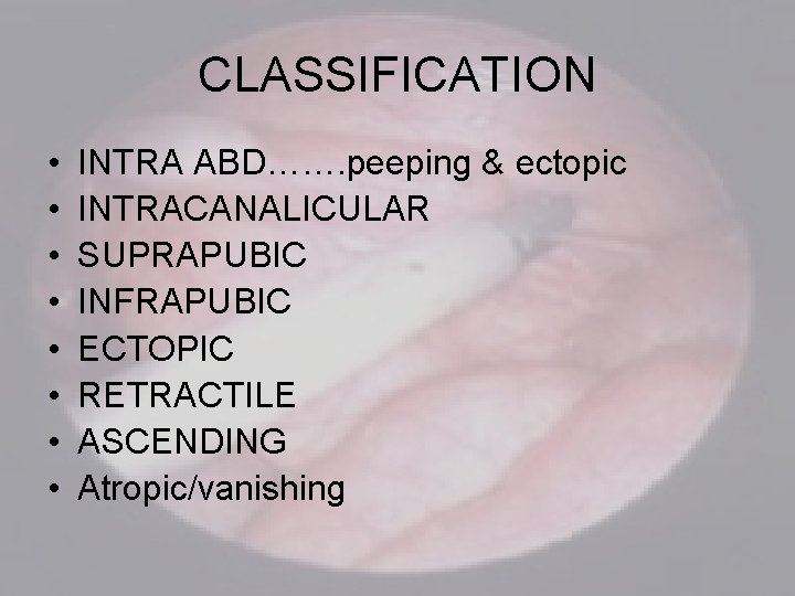 CRYPTORCHIDISM Dr GOVIND SRMC RI EMBROLOGY GONADAL RIDGE