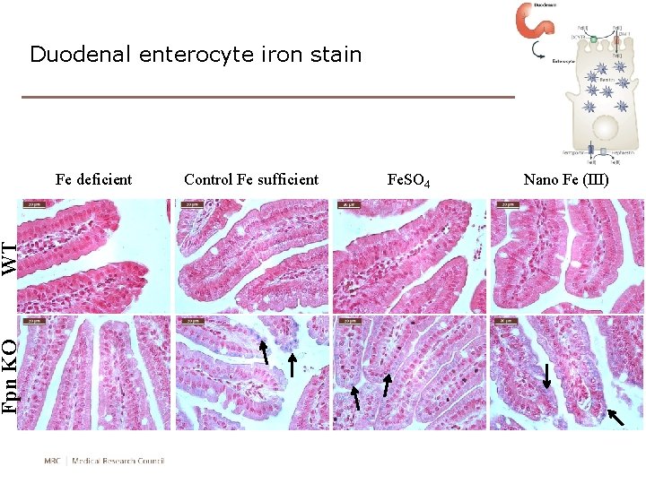 Mechanisms of absorption of iron from dietary nano