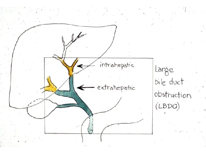 Liver Pathology 4 Biliary diseases Vascular diseases Parasites