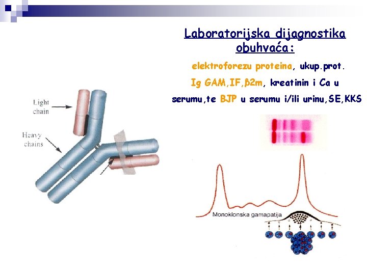 Laboratorijska dijagnostika monoklonskih gamapatija Danica Matii ...