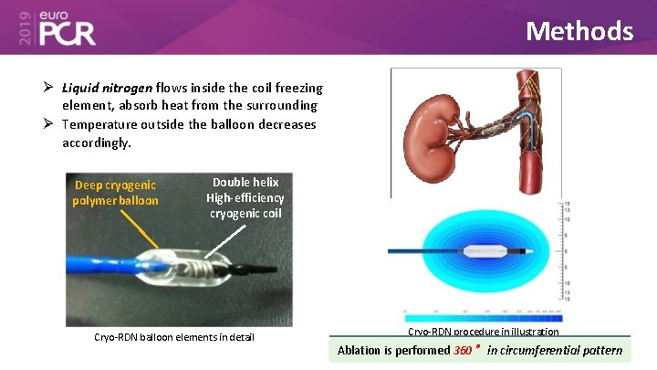 Validation of a novel catheterbased renal denervation system