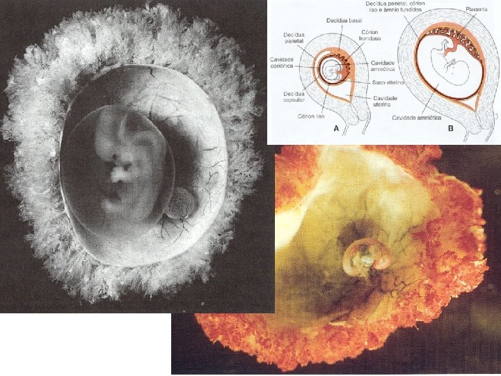 Embriologia Humana Tpico 7 placentao e perodo fetal