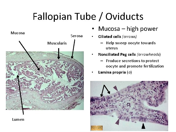Histology for Pathology Female Genital Tract and Breast