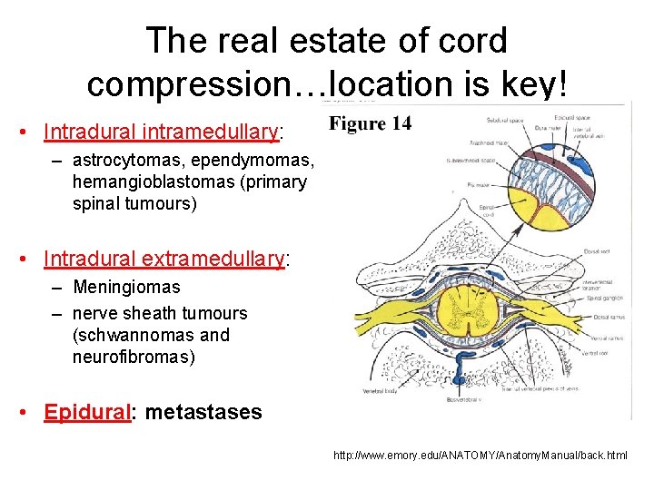 Spinal Cord Compression Neurology Academic day Emergency Lecture