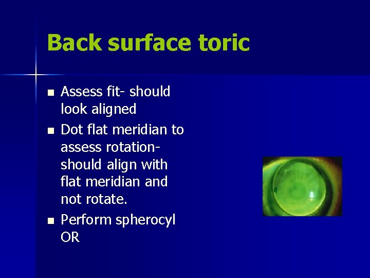Contact Lenses Overview of basics and considerations for
