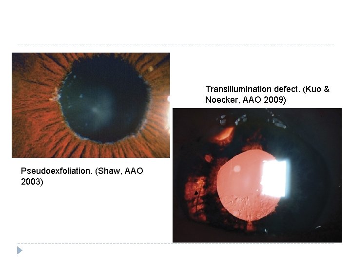 Chronic Visual Loss UBC Ophthalmology Club 2012 Approach