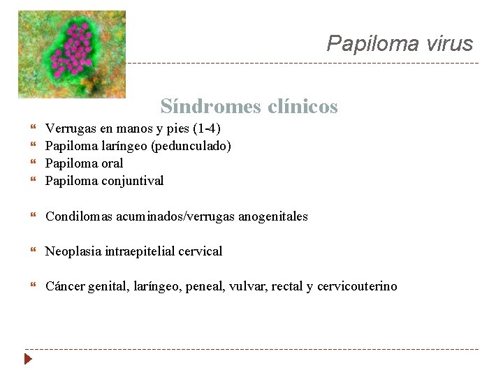 Virus del Papiloma Humano M Paz MICROBIOLOGA II