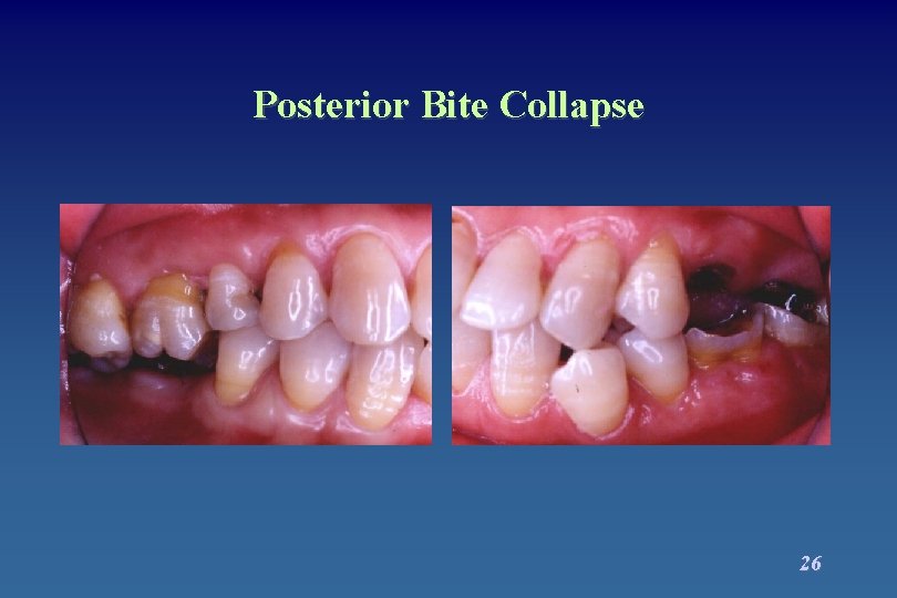 Charting Sequences in Periodontal Treatment Patients chief complaint