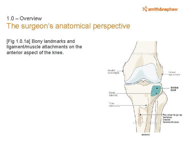 Ligament Balancing in Total Knee Arthroplasty Section1 Anatomy