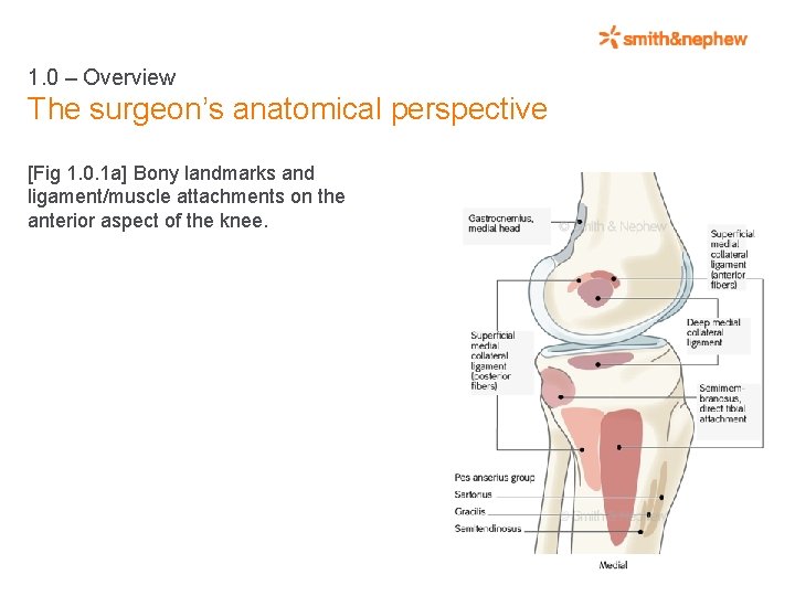 Ligament Balancing in Total Knee Arthroplasty Section1 Anatomy