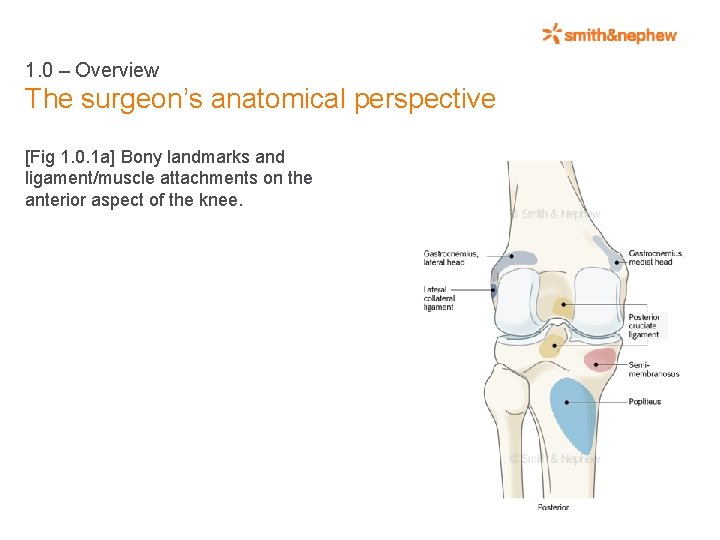 Ligament Balancing in Total Knee Arthroplasty Section1 Anatomy
