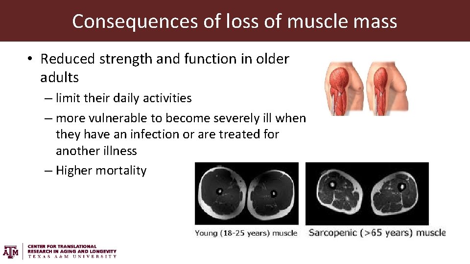 The Importance of Lean Body Mass Muscle in