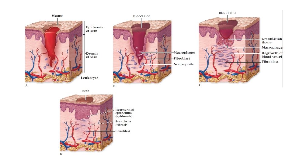 Mechanisms of Sports Trauma Tissue Response to Injury
