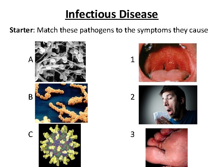 Infectious Disease Starter Match these pathogens to the