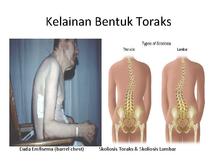 PEMERIKSAAN FISIK TORAKS Ani Sutriningsih Teknik Pemeriksaan Fisik