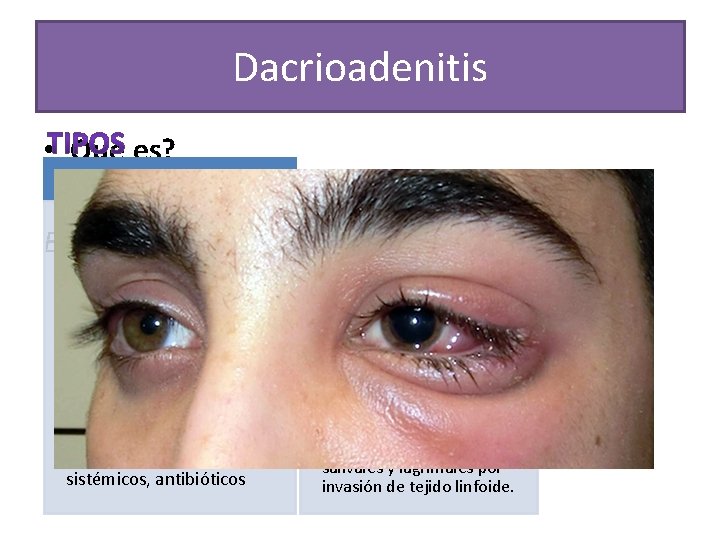 Aparato Lagrimal El aparato lagrimal del latn apparatus