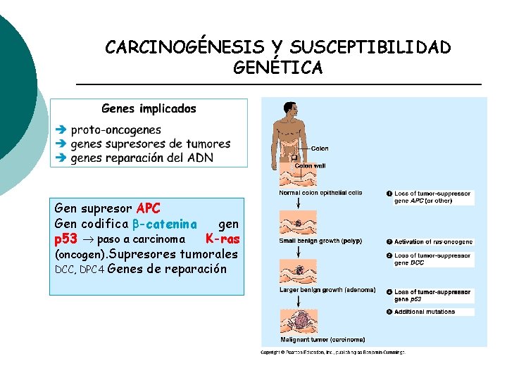 CANCER DE COLON Manuel Clemente Andjar Sesin interna