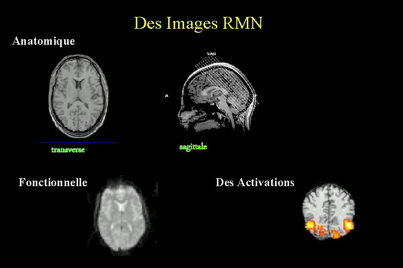 Utilisation de lIRM fonctionnelle pour ltude du fonctionnement
