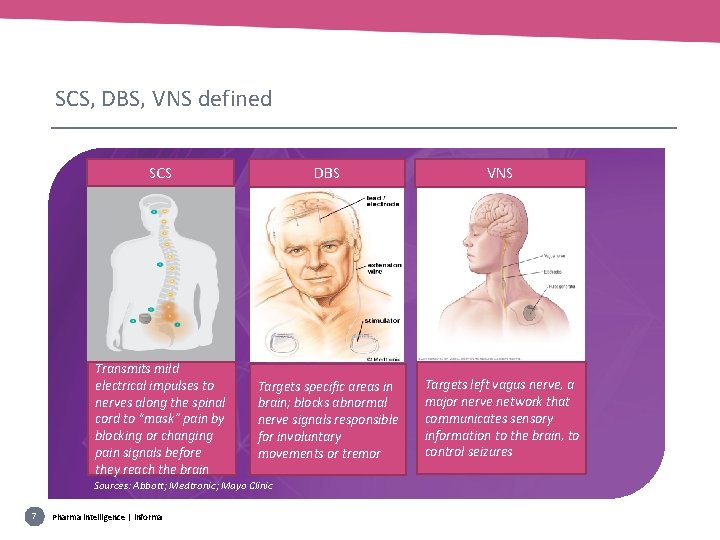 Neuromodulation Device Market Innovations and Trends Presenters Chrystal