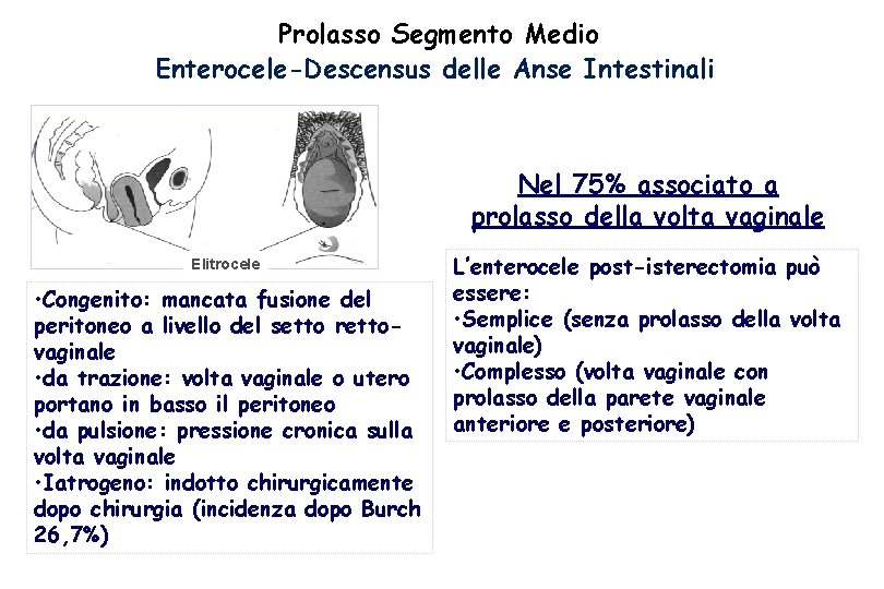 UROGINECOLOGIA UROLOGIA FEMMINILE I prolassi degli organi pelvici