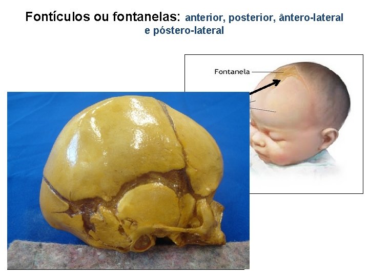 ANATOMIA TOPOGRFICA DA CABEA AULA 1 Introduo Ossos