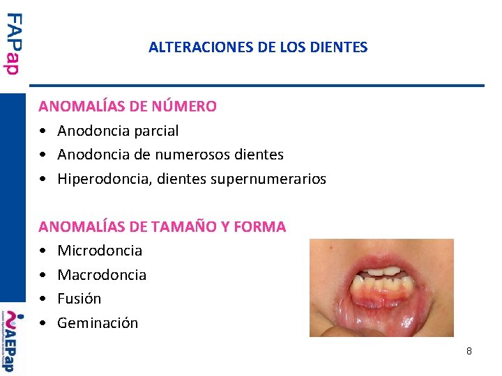 DENTICIN QU ES NORMAL Y QUE ALTERACIN M