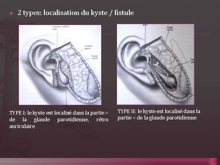 LES MASSES CERVICALES KYSTIQUES Dr ENNEDDAM Pr IDRISSI