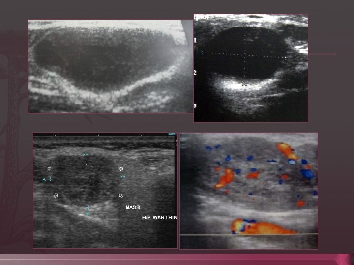 LES MASSES CERVICALES KYSTIQUES Dr ENNEDDAM Pr IDRISSI