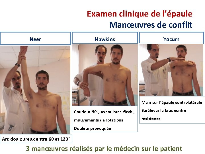 Conduite tenir devant LIRPOS URAC 30 une paule