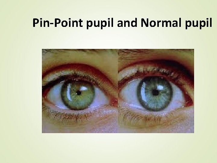 Organophosphate Poisoning BY Guided by Group No 19