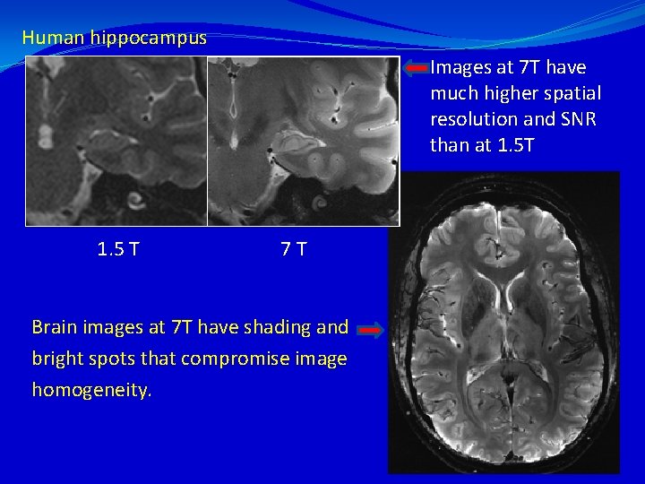 Brain Phantoms for Ultra High Field MRI Sixweek