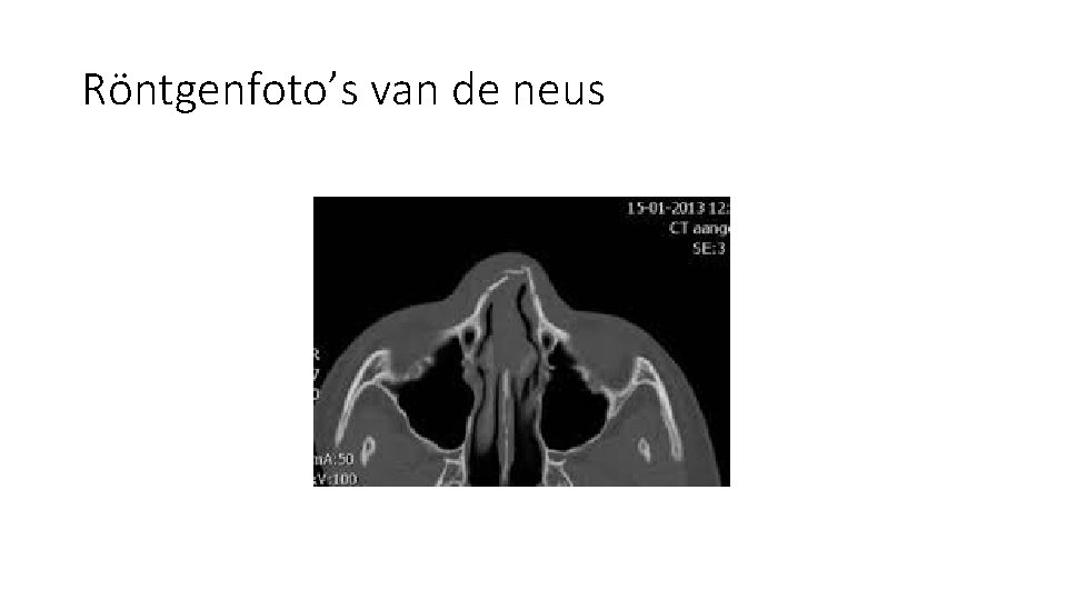Voordracht Keel Neus Oor voor doktersassistenten Ida van