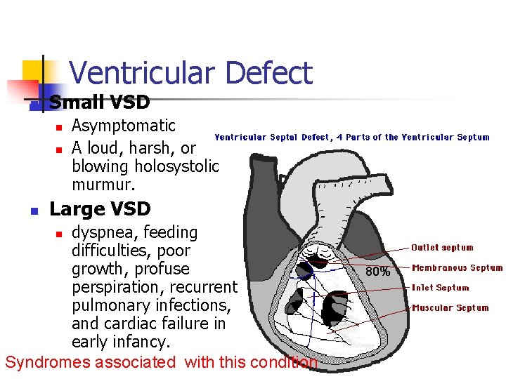 Approach to child with heart disease Pushpa Raj