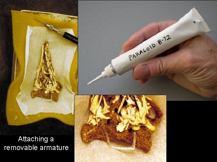 The use of cyanoacrylates and Butvar B76 polyvinyl