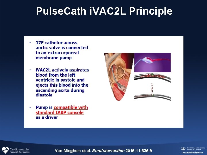 Hemodynamic Talk New Mechanical Circulatory Support for High