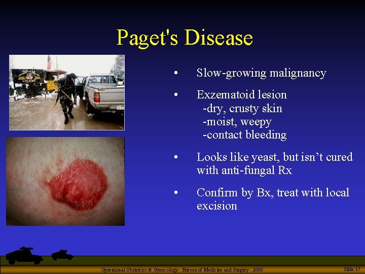 Vulvar Lesions CAPT Mike Hughey MC USNR Operational