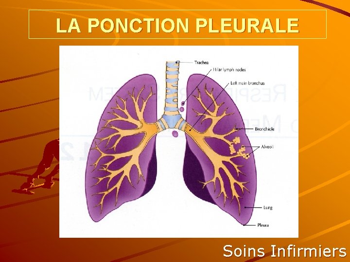 LA PONCTION PLEURALE Soins Infirmiers LA PLVRE La
